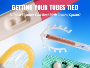 Getting Your Tubes Tied: Is Tubal Ligation Your Best Birth Control ...